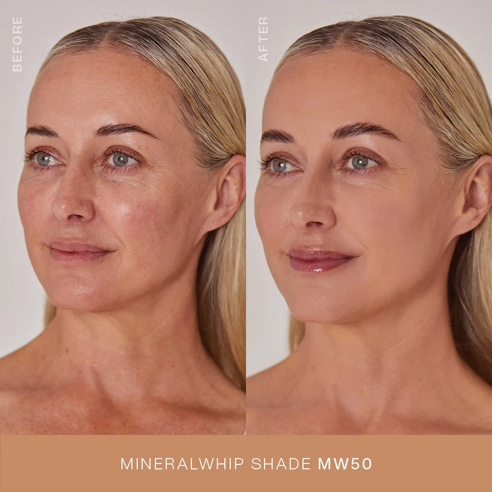 MineralWhip MW50 – Dr Matulich Dermatology